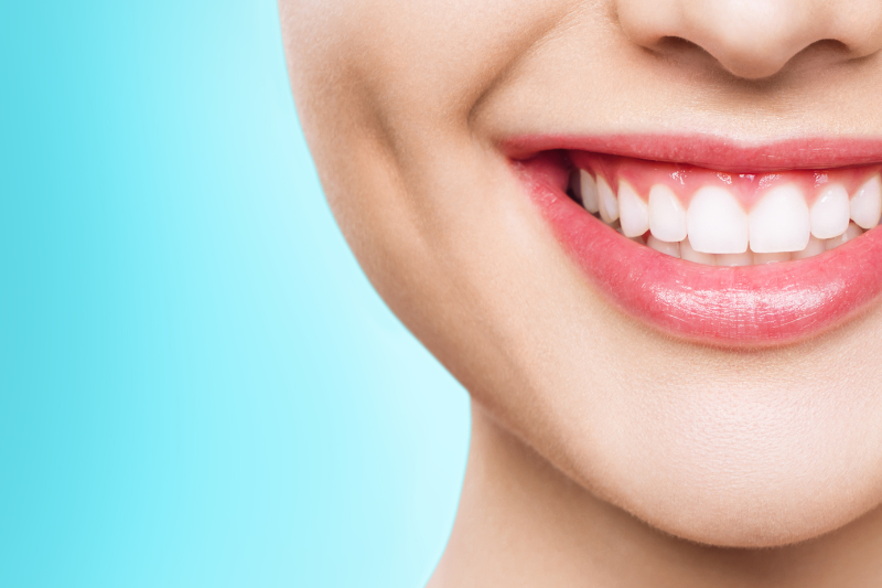 Smile Makeover - Dental Design Concepts